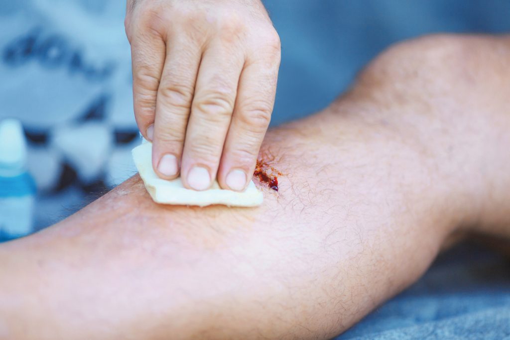 Incredible Uses For Hydrogen Peroxide You Never Knew | Crafthought